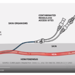 Prevantics® Device Swab & Strip | PDI Healthcare